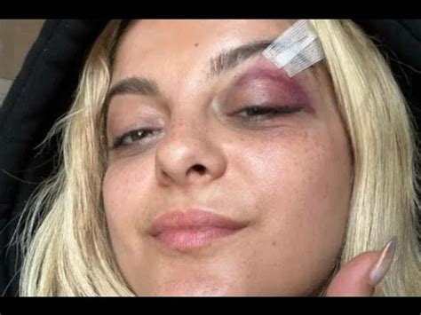 Suspect Allegedly Told Cops Why He Threw Phone At Bebe Rexha Vidéo