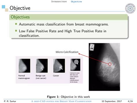 Classification Of Breast Masses Using Convolutional Neural Network As