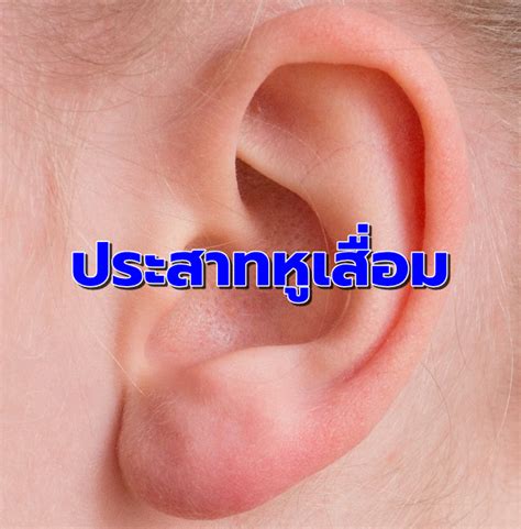 โรคประสาทหูเสื่อม อีกความเสี่ยงคนทำงาน The Bangkok Insight