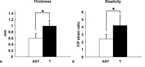 Figure 3 From Stiffness Of The First Annular Pulley In Normal And Trigger Fingers Semantic