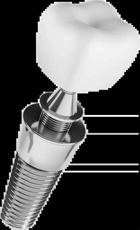 واردات فیکسچر ایمپلنت بهدار تجهیز