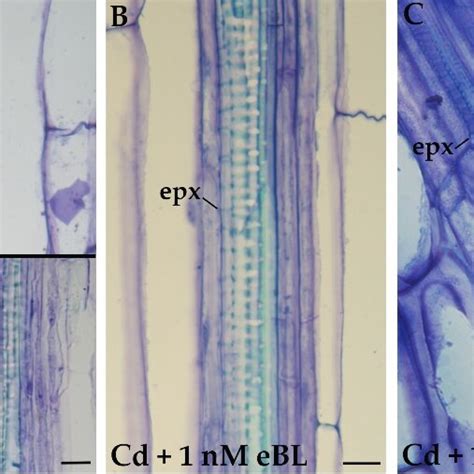 Stelar Structure Of The Basal Hypocotyl Of A Thaliana Col Ecotype