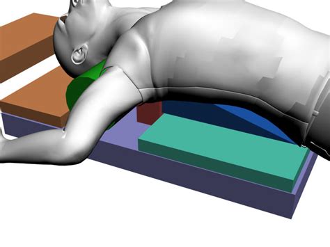 Posture Blocks Keefe Clinic