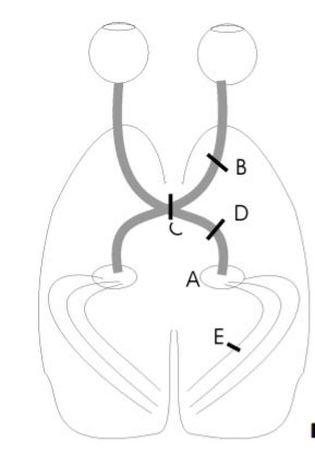 Visual System Flashcards Quizlet