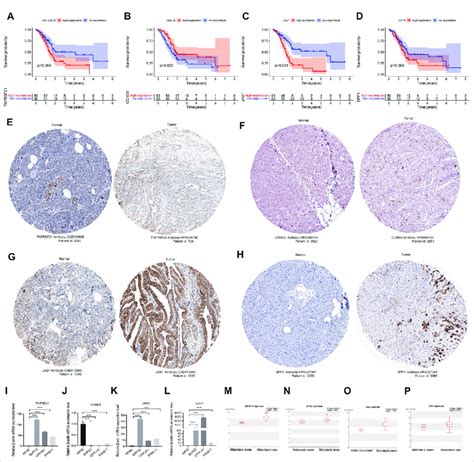 Validation Of Angiogenesis Associated Risk Genes In Pc A D Survival