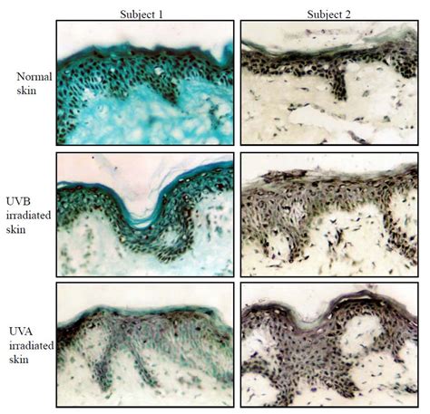 Effects Of UVA And UVB On NFAT TonEBP Localization In Human Epidermis Download Scientific