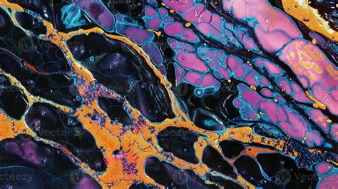 Thin Sections Of Brain Tissue Showing The Distinct Bands Of Myelin
