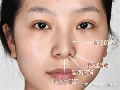 鼻基底凹陷的自测方法 知乎