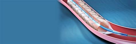 How Safe Is The Primary Pci Dr Viveka Kumar