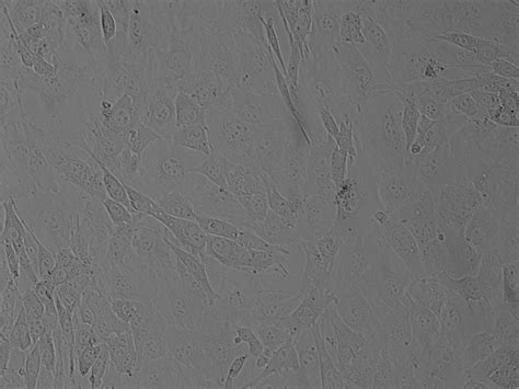 Can Anyone Help With Bj6s Human Dermal Fibroblast Morphology Researchgate