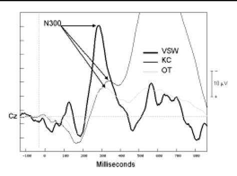 Grand Mean Waveforms At Cz For Sites For Vertex Sharp Wave K Complex