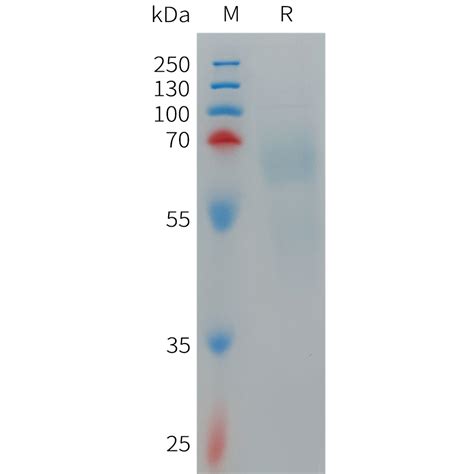 Human Il12a And Il12b Heterodimer Protein Hfc Tag And His Tag Dima