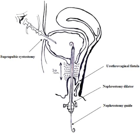 Schematic Presentation Of The Procedure Download Scientific Diagram