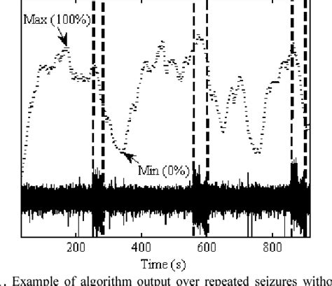 Figure 1 From Closed Loop Seizure Prediction And Prevention In Rats