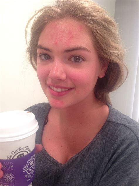 A Linda Modelo Kate Upton Também Foi Vitima Desse Hacker Que Já é
