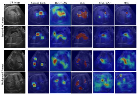 Attention Maps Generated By Different Variations Of The Generator From