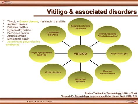Vitiligo In Association With Erythema Dyschromicum Perstans Ppt