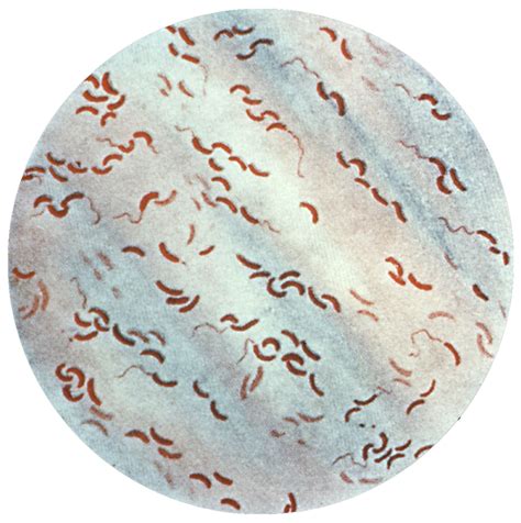 Vibrio Comma Doccheck