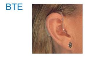 Tipos De Aud Fonos Serrano Audi Logos