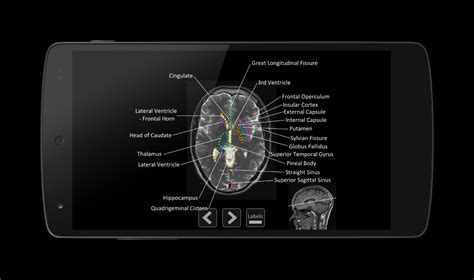 Atlas Of Mri Brain Anatomy Latest Version 11 For Android