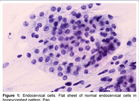 Endocervical Cells
