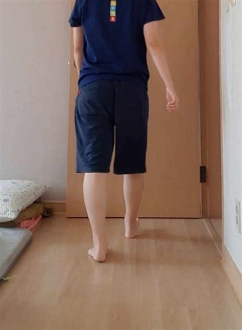 대퇴골 전자간 골절 수술 후 3개월차 걸어보기 네이버 블로그