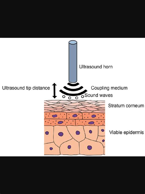 Schematic Representation Of Low Frequency Ultrasound Application On Skin Surface Pdf