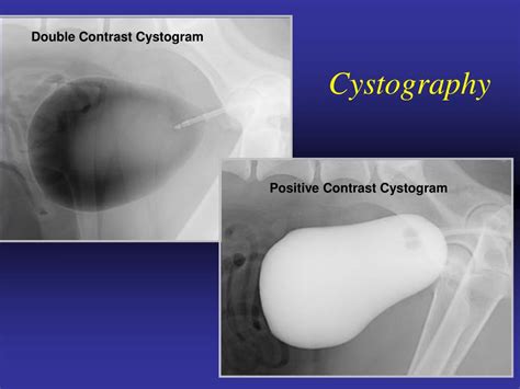 Ppt Imaging The Urogenital System Powerpoint Presentation Free