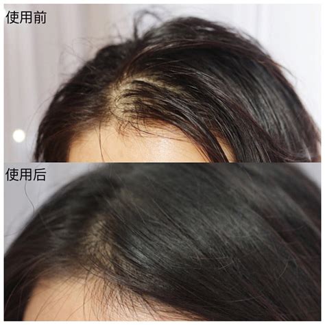 头发太油时间紧不方便洗头有了它就能三秒轻松变回干爽秀发 头发太油时间紧不方便洗头有了它就能三秒轻松变回干爽秀发 emmm