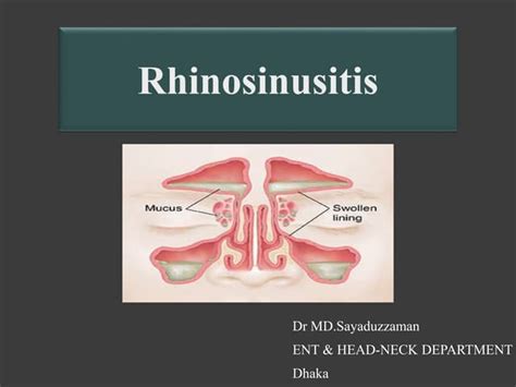 Rhinosinusitis Acute Chronic Fungal Ent Pptx