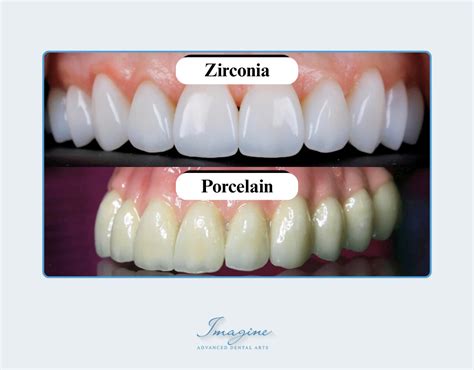 Porcelain And Zirconia Dental Crowns Imagine Advanced Dental Arts