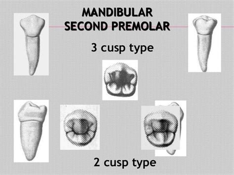Permanent Mandibular First Premolar And Differences Between First And…