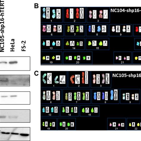 Cytokeratin Expression And Spectral Karyotyping SKY Analyses Of