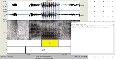Red Lines On The Spectrograph Of Sound [ae] Indicate The Four Formants