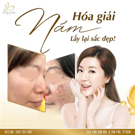 Miss M Spa Gò Vấp Vua TrỊ MỤn RỖ Chân Mày Điêu Khắc Hiệu ứng Sợi