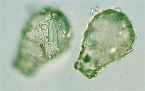 Protist Images Difflugia Oblonga