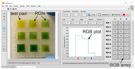 3d Printed Hydrogel Sensor For Rapid Colorimetric Detection Of Salivary Ph