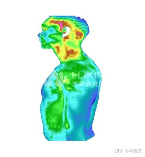 医用红外热像仪检查结果准确吗 知乎