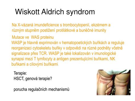 PPT Buněčné imunodeficience a syndrom diGeorge PowerPoint