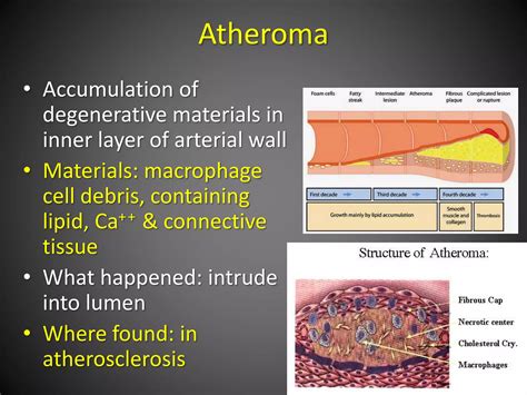 Peripheral Vascular Disease Ppt