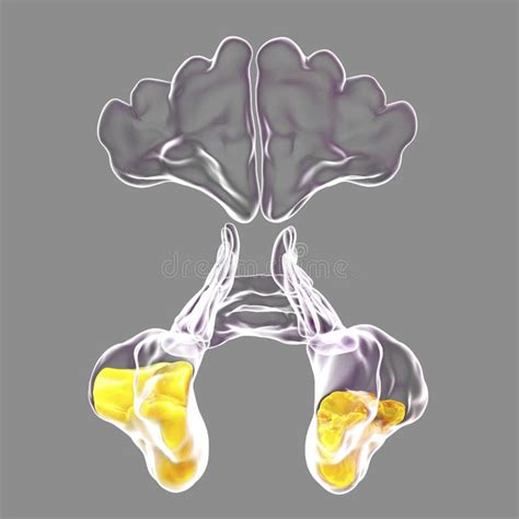 Diffuse Maxillary Sinusitis Stock Illustrations 5 Diffuse Maxillary