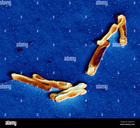 Clostridium Difficile Bacteria Coloured Transmission Electron