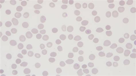 Infected Cell Detector Object Detection Model By Malariadetector