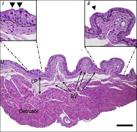 Rectoanal Junction Histology Labeled