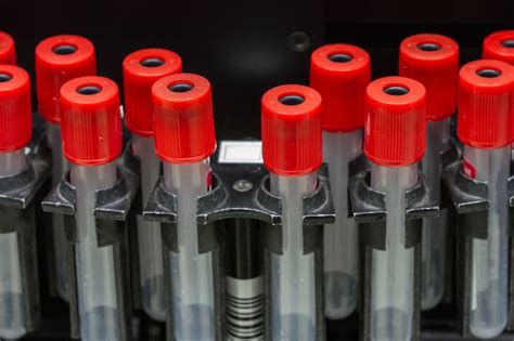화학 실험실 의료 기기의 의료 혈액 분리 시험 원심 분리기 프리미엄 사진