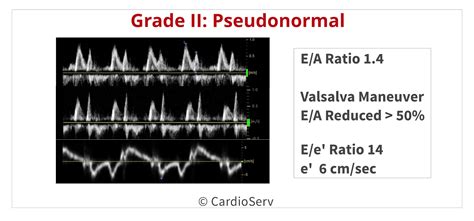 What Is Lv Diastolic Dysfunction Natural Resource Department