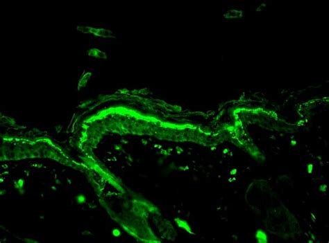 Anti Dnarna Damage Antibody 15a3 Ab62623 Abcam