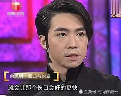 俞灝明燒傷後拒絕植皮，首次曝光真相，網友：打臉女明星！ 每日頭條