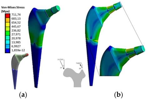 Topology Optimization Of A Femoral Stem In Titanium And Carbon To Reduce Stress Shielding With