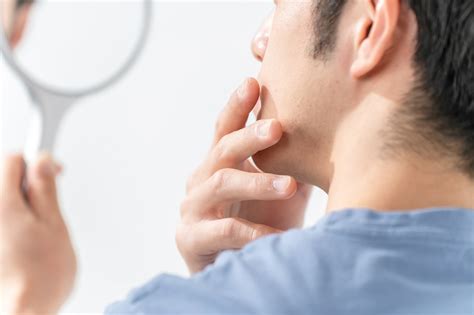 【楽天市場】brand Beauty Men｜美容記事｜シミとそばかすの違いは？予防法を詳しく解説
